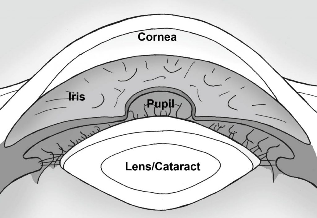 Chapter 1: Introduction to Cataracts - TimRoot.com